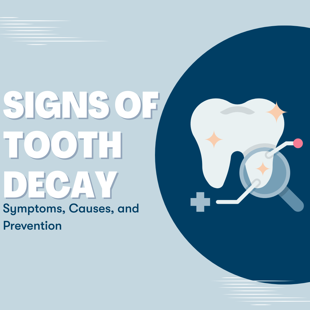 Signs of Tooth Decay: Symptoms, Causes, and Prevention - Associates In ...